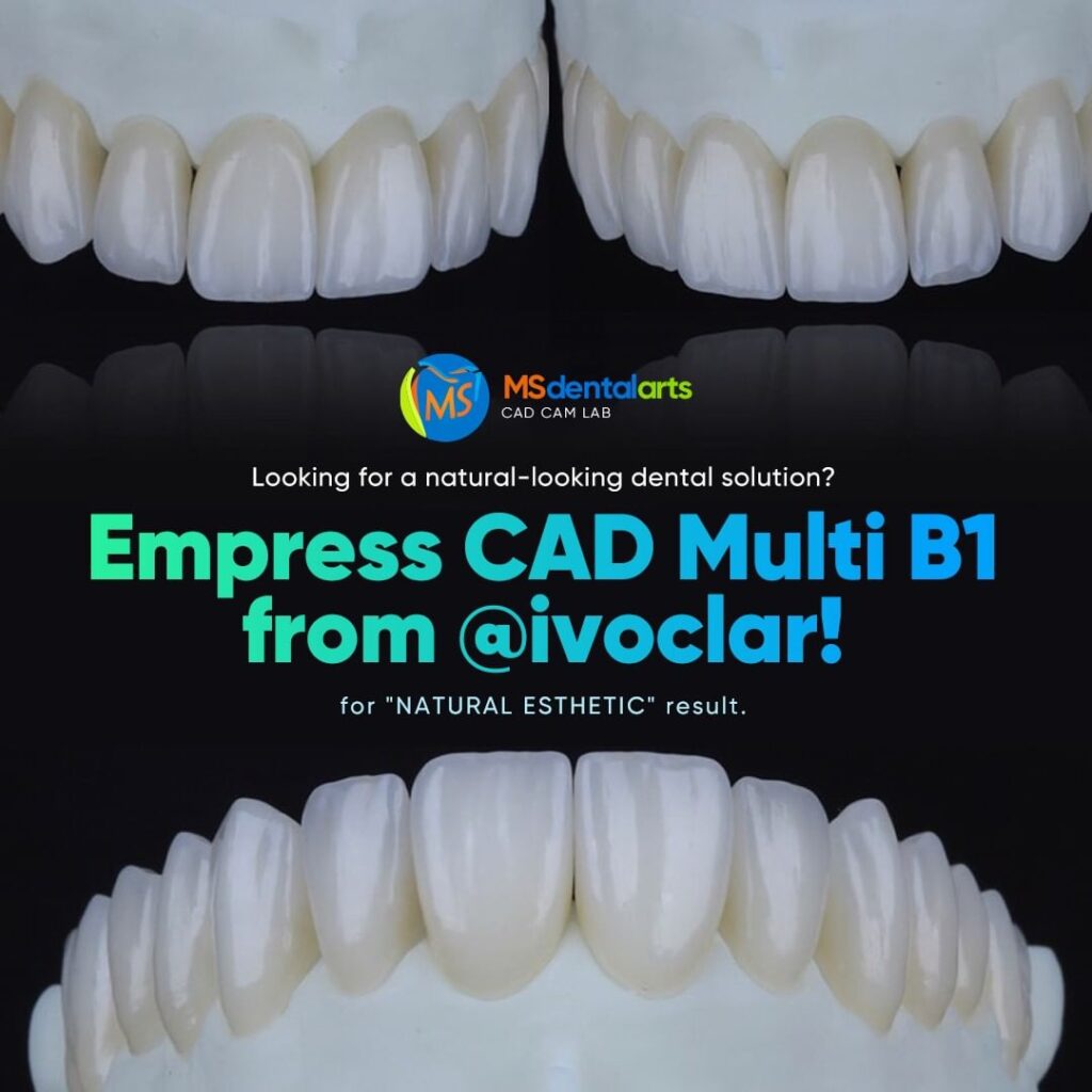 Empress Multi CAD B1 from Ivoclar | MS Dental Arts